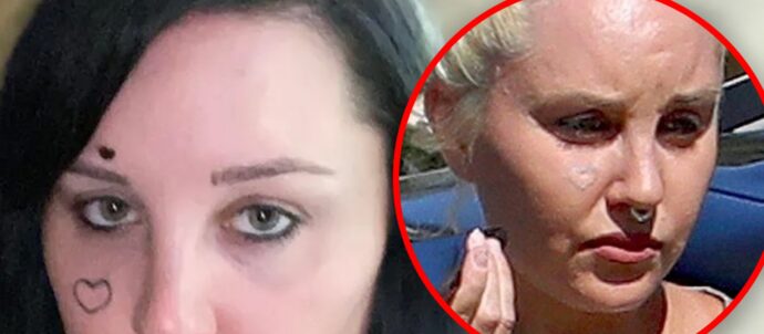 Amanda Bynes Appears to Be Removing Face Tattoo After Mental Health ...